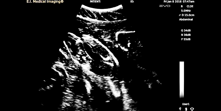 World's First Tiger Shark Ultrasound Reveals SO MANY Babies